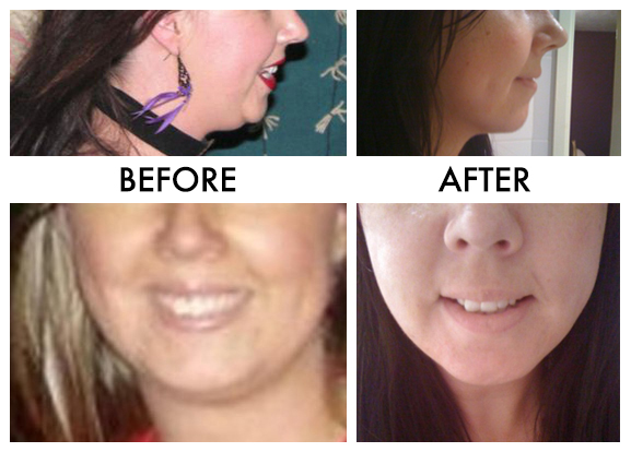 Facial Procedures Archives - MYA Space